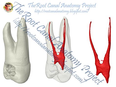The Root Canal Anatomy Project Three Rooted Maxillary Premolar