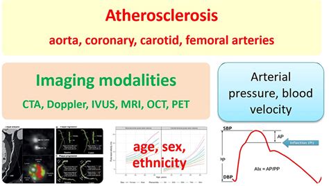 Sex Differences In Diagnostic Modalities Of Atherosclerosis In The