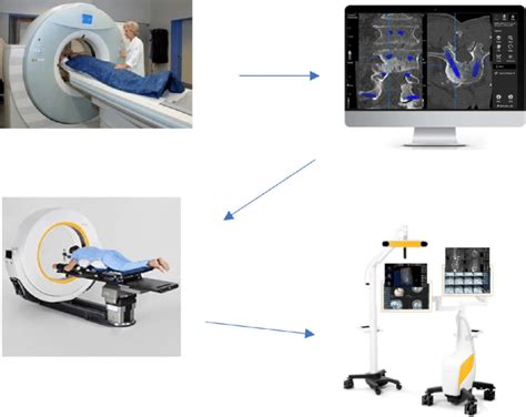 Flowchart Illustrating The Workflow Of Preoperative Screw Position