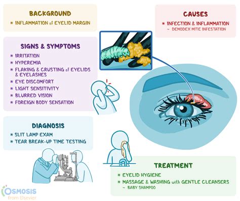 Blepharitis What Is It Causes Diagnosis And More Osmosis