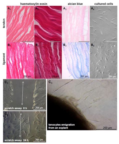 Cells Free Full Text Decellularized Tendon Extracellular Matrix—a Valuable Approach For