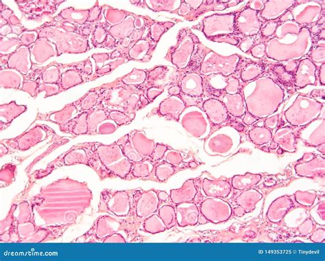Histology Of Human Thyroid Gland Tissue Stock Image Image Of Cell
