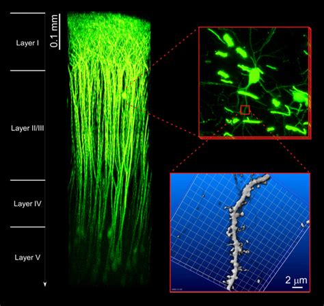 få îáîç images of the cerebral neocortex of an anesthetized mouse Download Scientific Diagram
