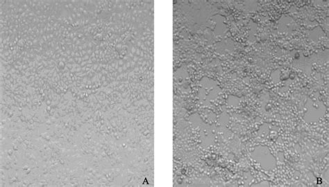 Virus Induced Cytopathic Effect By Rescued Swsd32005 At