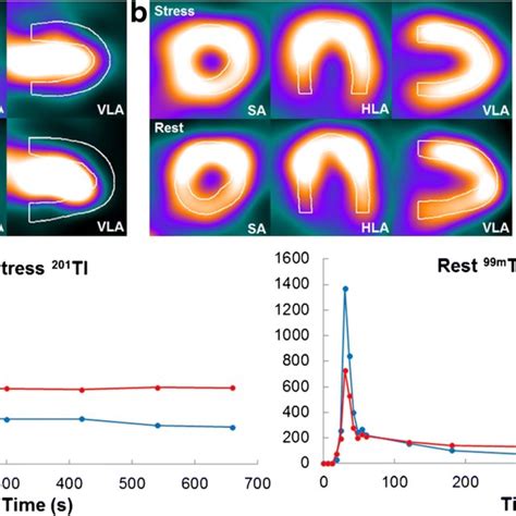 Representative Dynamic Spect Images And Timeactivity Curves After