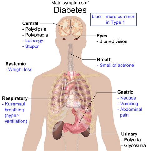 Gestational Diabetes Pregnancy Diabetes Md Searchlight
