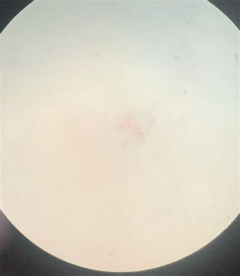 Gram Stain Slide Diagram Quizlet