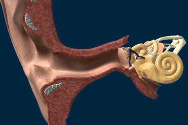Ears Healthdirect