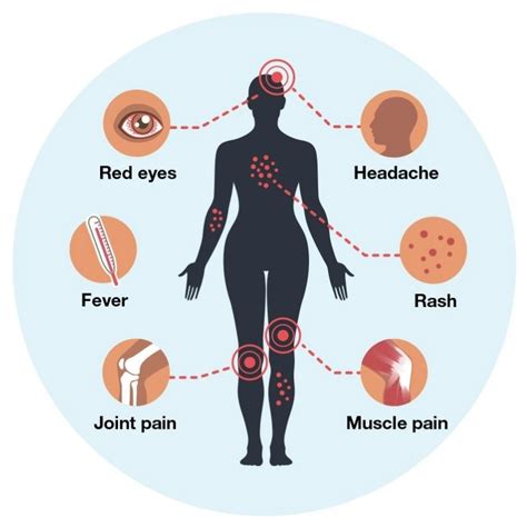 Zika Virus Disease What Are The Causes Symptoms And Treatment Of This