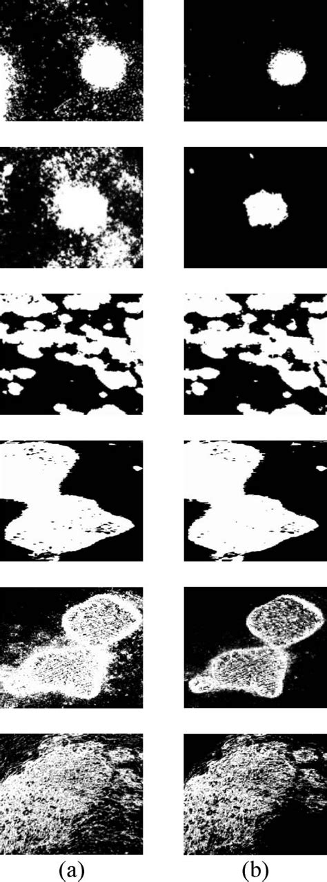 A Segmentation Result Using Only K Means Clustering B Segmentation Download Scientific
