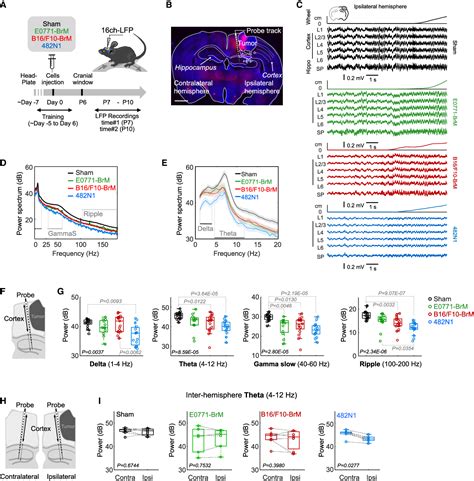 Figure 1 From Machine Learning Identifies Experimental Brain Metastasis Subtypes Based On Their