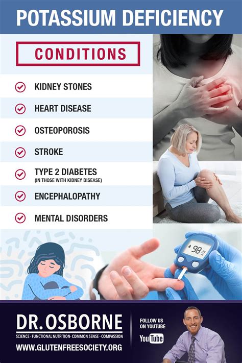 Hypokalemia Disease