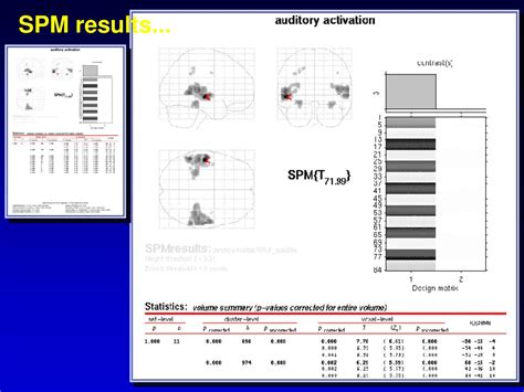 Ppt Parametric Thresholding Methods Random Field Theory And False Discovery Rate Powerpoint