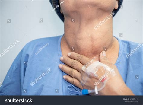 Enlarged Multinodular Thyroid Goiter Middleaged Asian Photo De Stock Modifiable