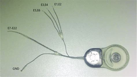 Cochlear Vestibular Neuroprosthesis Electrode Configurations Are