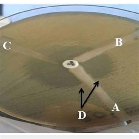 Double Disk Synergy Test Showing Positive Result Of Esbl Production By Download Scientific