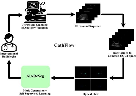 [论文审查] Cathflow Self Supervised Segmentation Of Catheters In Interventional Ultrasound Using