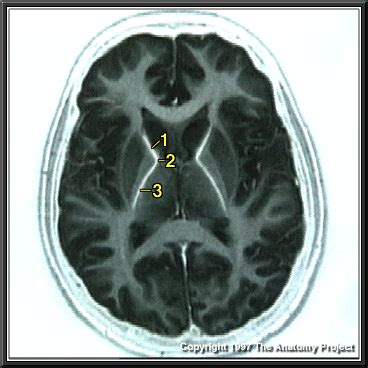 Gross Anatomy Image