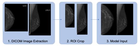 Using Retrieval Augmented Generation RAG On A Custom PDF Dataset With Dell Technologies Dell