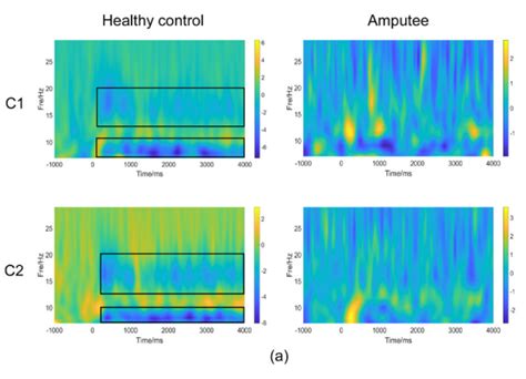 Abnormalities Of Event Related Desynchronization In Patients With Lower