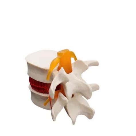 Human Intervertebral Disc Event Spinal Model Intervertebral Disc Model