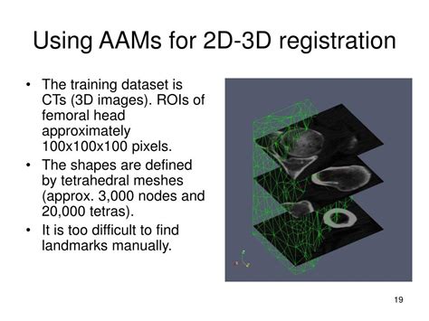 Ppt Intensity Based Deformable Registration Of 2d Fluoroscopic X Ray Images To A 3d Ct Model