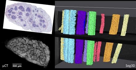 An Example Of A Rat Sciatic Nerve Segmentation C D With Its Download Scientific Diagram