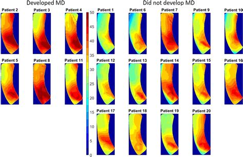 Toward A Skin Dose Area Metric Predictive Of Moist Desquamation Using In Vivo Skin Dosimetry And