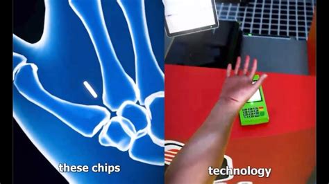 How A Microchip Implant Works Remember This Is BIBLE Prophecy If You Watching This DONT