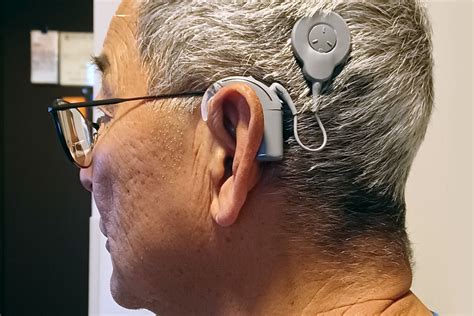 Cochlear Implant Returns Patients Hearing Keck Medicine Of Usc