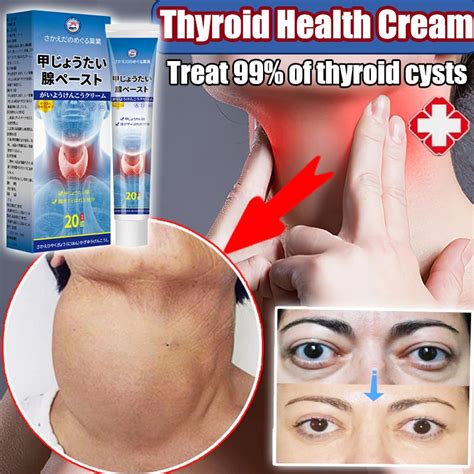 Japan Thyroid Cream 20g Thyroid Nodule Ointment Thyromegaly Neck Lipoma