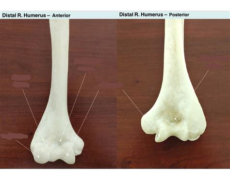 Distal R Humerus Anterior And Posterior Quiz