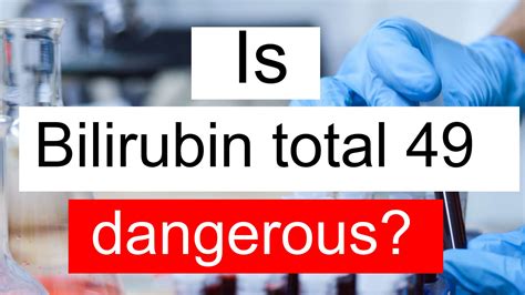 Is Serum Bilirubin Total 49 High Normal Or Dangerous What Does Serum Bilirubin Total Level 49