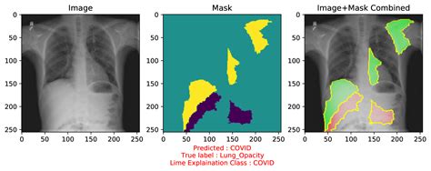 Comprehensive Lung Disease Detection Using Deep Learning Models And Hybrid Chest X Ray Data With