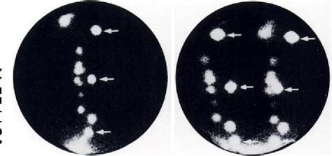 Figure 1 From The Three Dimensional Localization Of Internal Mammary