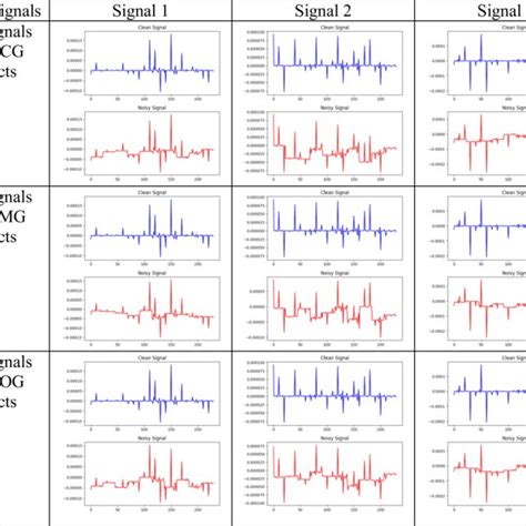 Sample Signals Of Dataset 1 For Developed Artifacts Removal Model Download Scientific Diagram