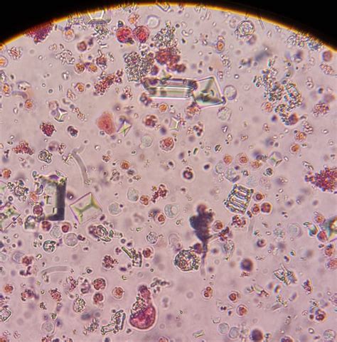 Sedimento Urinario Activo teñido Grupo Zoovet