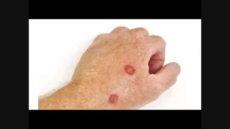 علائم دیابت نماشا