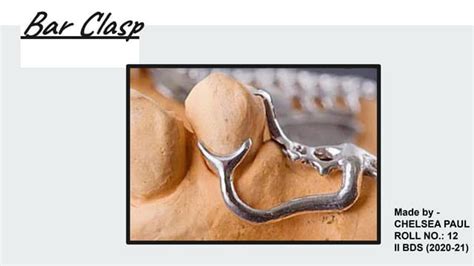 Bar Clasp Pdf