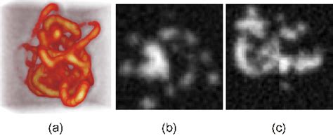 An Example Of Phantom Data Set Used For Segmentation Validation A Download Scientific