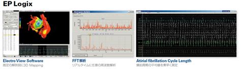 Labsystem™ Pro Epレコーディングシステム 医療従事者の方 ボストン・サイエンティフィック ジャパン