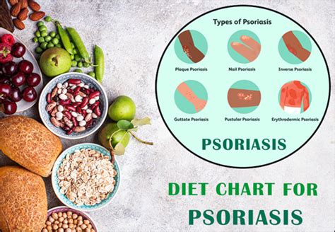 Diet Chart For Psoriasis Food To Take Food To Avoid