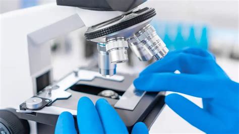 Understanding Scalp Biopsy Procedure Purpose And Benefits