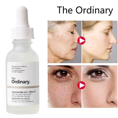 Ordinary Niacinamide 10 + Zinc 1 - The Ordinary Niacinamide 10 Zinc 1 ...
