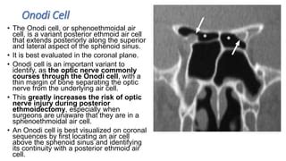 Basics Of Ct Scan Interpretation Of Paranasal Sinusespptx