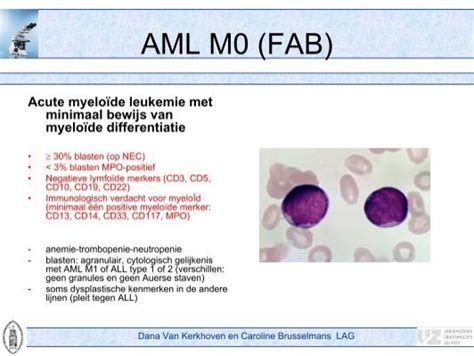 Aml M7 Fab Acute Megaka