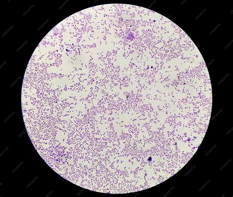 Premium Photo Staphylococcus Aureus Bacteria Colonie Gram Stain Microscopic 100x Image