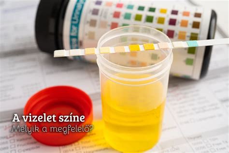 Mi A Helyes Vizelet Színe és Mit árul El Róla Prosztataeu