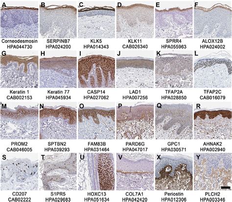 Protein Expression On At Pat Gray Blog