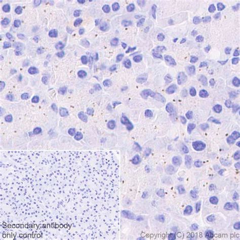 Anti Pericentrin Antibody Epr21987 Centrosome Marker Ab220784 Abcam